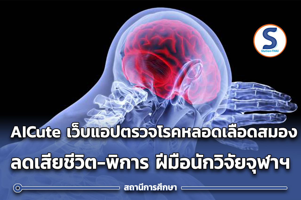 "AICute" เว็บแอปตรวจประเมินโรคหลอดเลือดสมองที่มีสาเหตุจากโรคหัวใจ รักษา ...